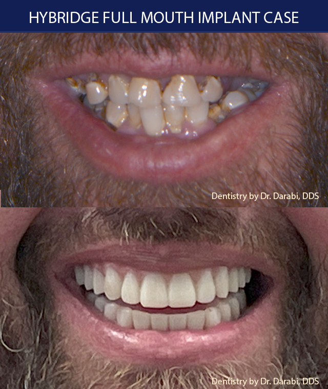Gallery | Dentist in Massachusetts
